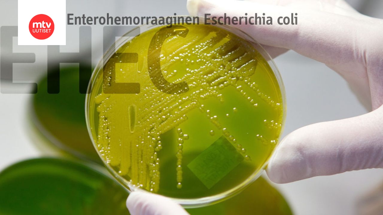 Ehec-bakteeri sairastuttanut yli 1 500 Saksassa, tänään 365 uutta ...