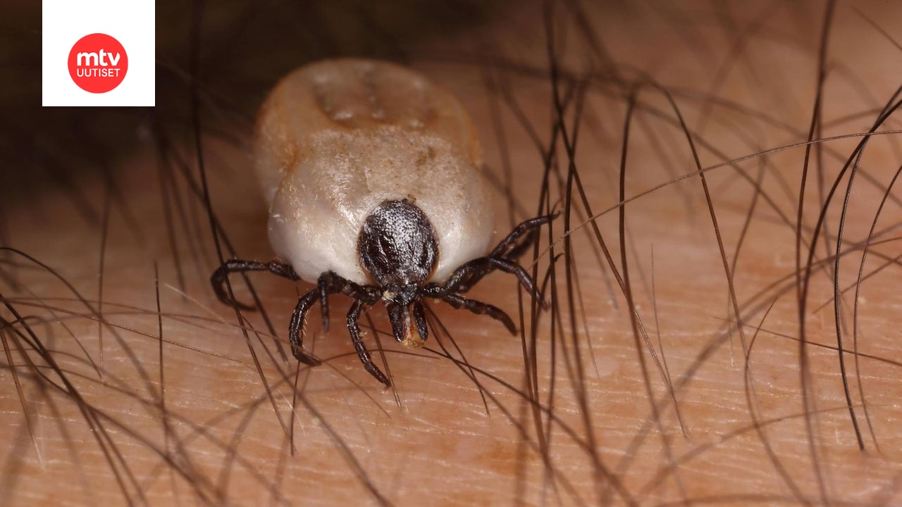 Tiesitkö? Punkin purema voi aiheuttaa punaisen lihan allergian ...