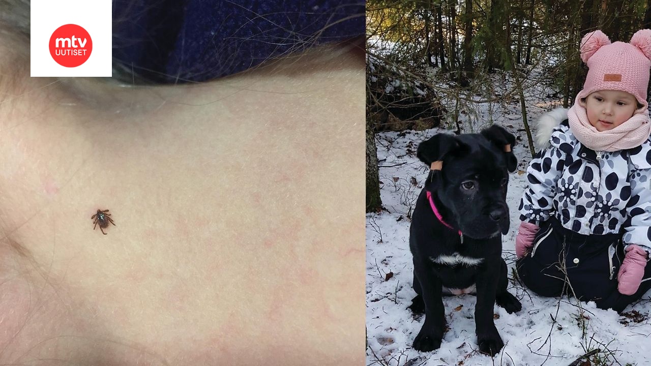 20 astetta pakkasta ja punkki pikkutytön niskassa – poikkeuksellinen ...