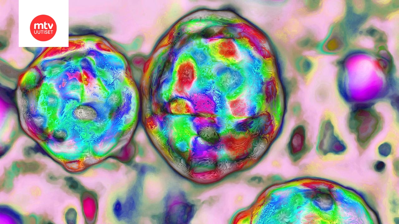 Tuhkarokko jyllää myös Kongossa: kahdelle miljoonalle lapselle ...