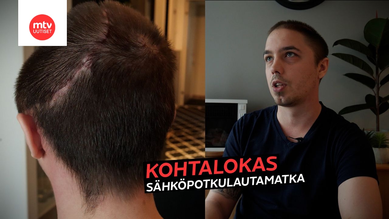 Taavi, 25, lähti sähköpotkulaudalla baarista kotiin, kunnes kaikki ...