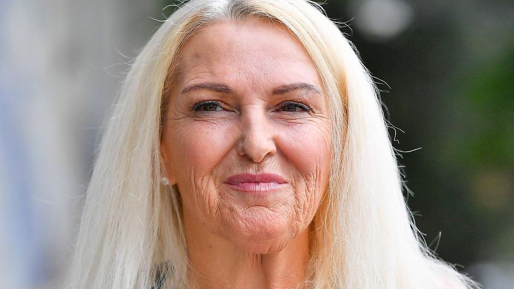 90 päivää morsiamena -tähti Angela Deem uudessa kauneusleikkauksessa ...