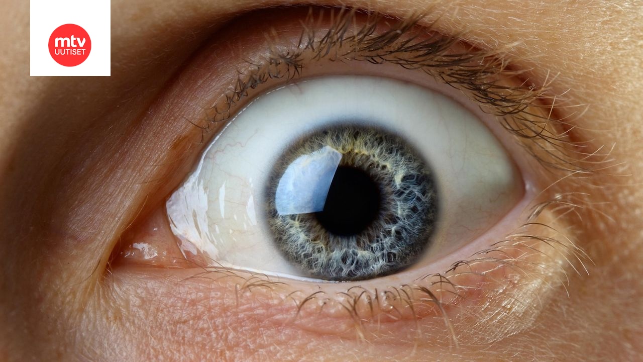 Brasiliaismies osaa pullautella silmämuniaan pisimmälle - MTVuutiset.fi