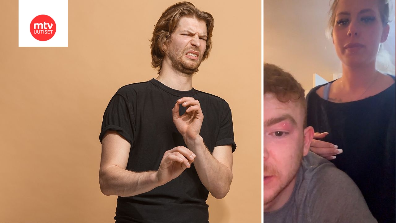 Tyttöystävä puristi miehen silmäluomesta mätää täynnä olleen kystan ...