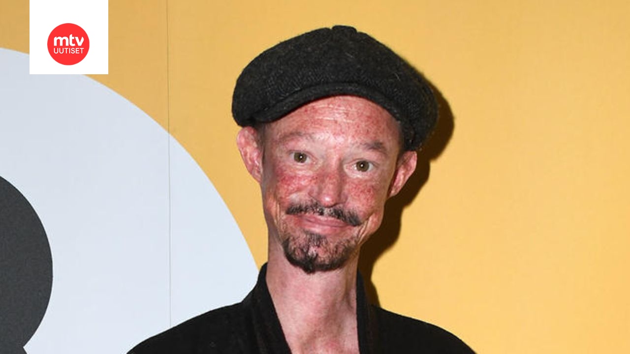 Game of Thrones -tähti Darren Kent on kuollut - MTVuutiset.fi