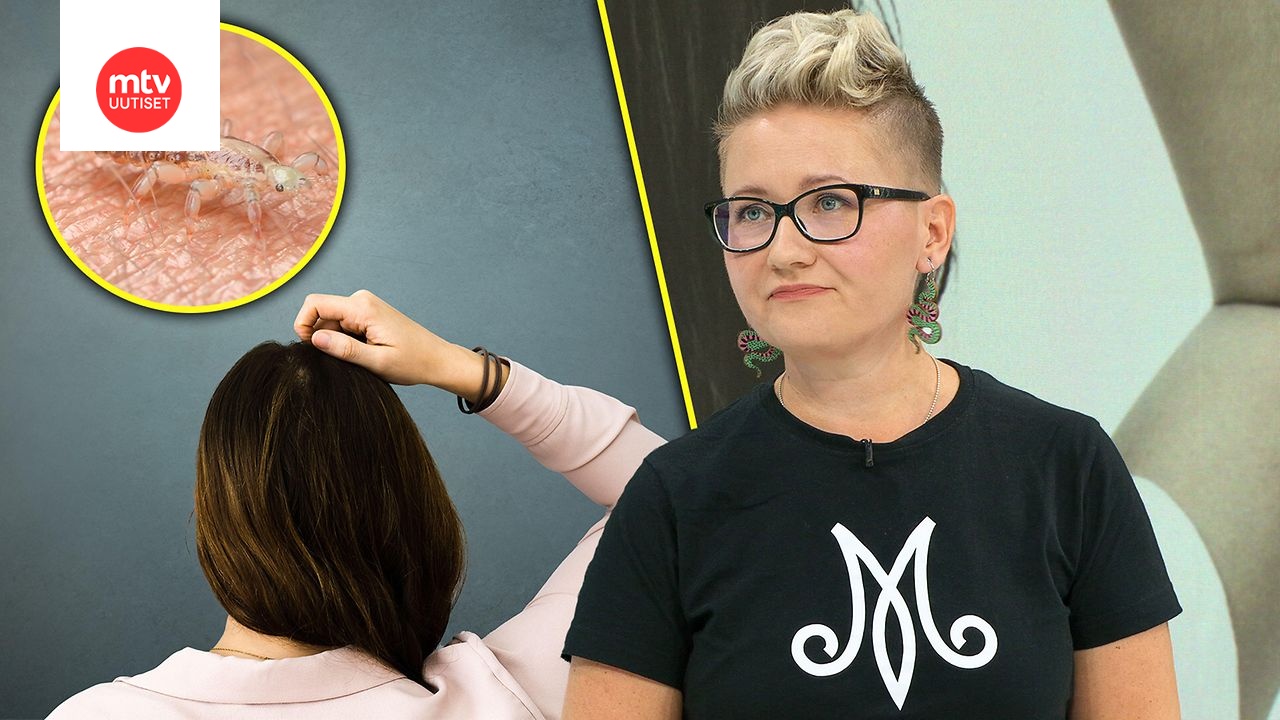 Miten päätäit, kihomadot ja syyhypunkit tarttuvat sekä miten niitä ...