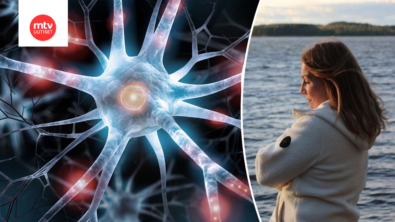 Hemipleginen migreeni oireilee halvauksina - MTVuutiset.fi