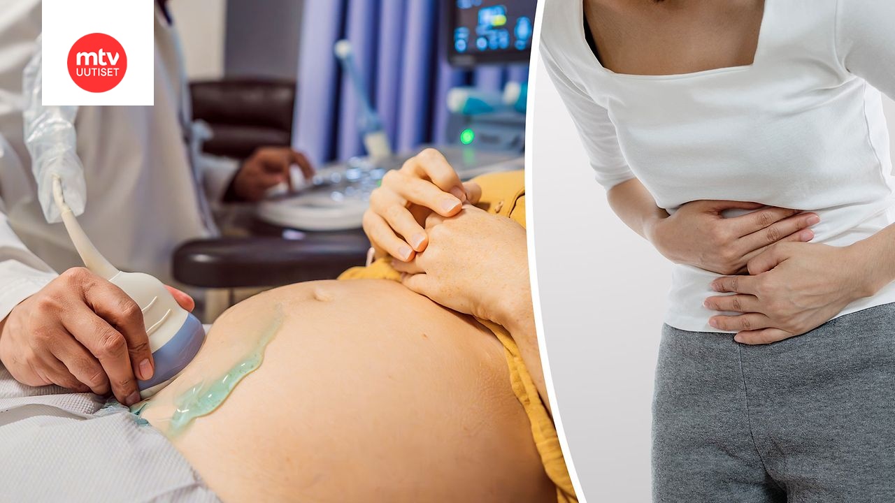 Naisen "vatsakipu" olikin kohdunulkoinen raskaus - MTVuutiset.fi