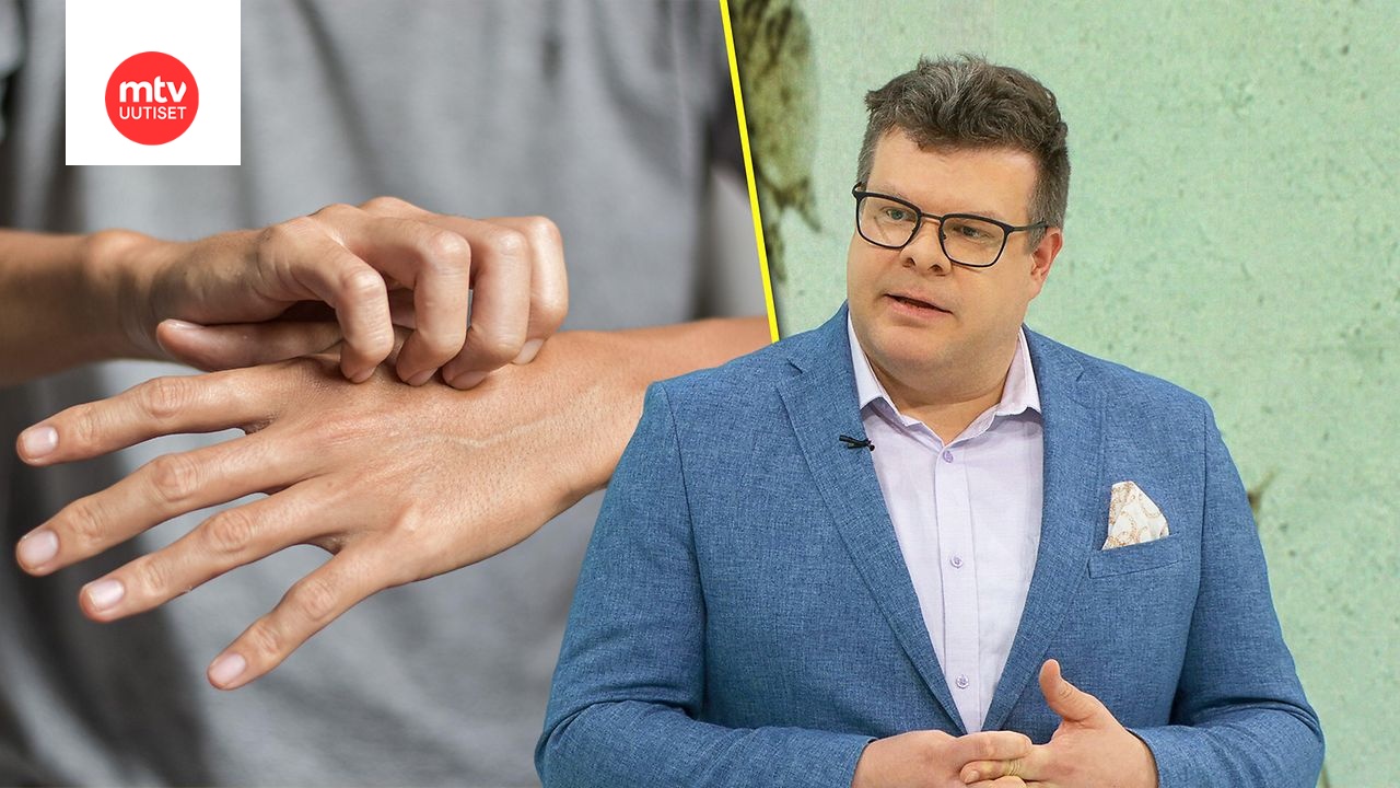 Syyhy voi tarttua seksissä - MTVuutiset.fi