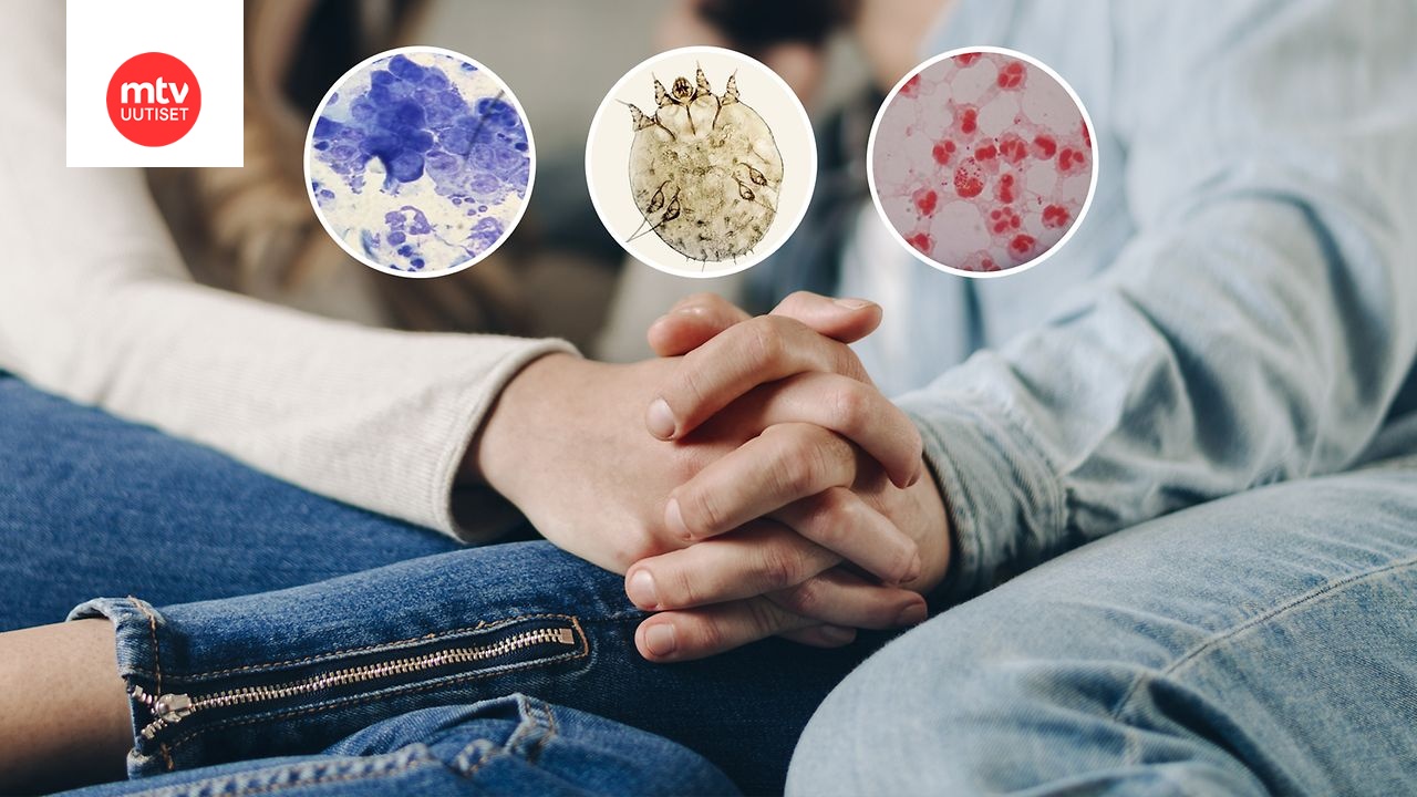 Syyhy, klamydia ja tippuri leviävät nyt Suomessa - MTVuutiset.fi