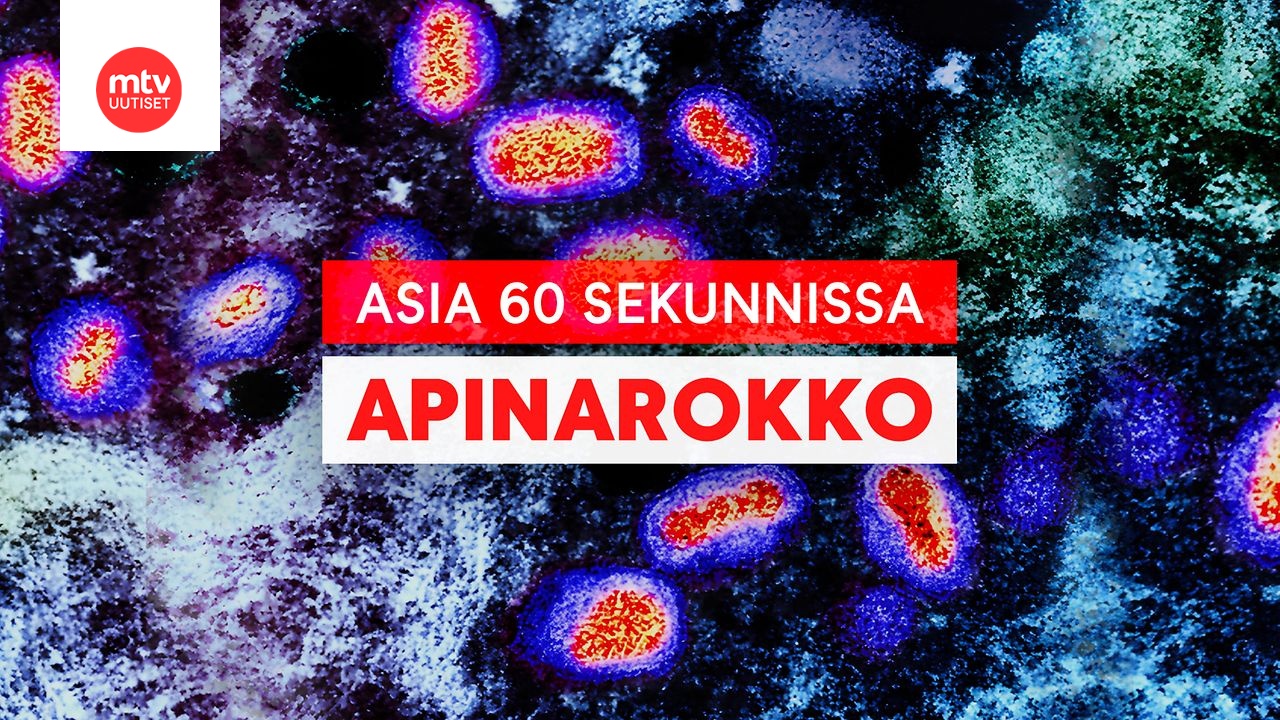 Näin apinarokko tarttuu, tauti selitettynä 60 sekunnissa - MTVuutiset.fi