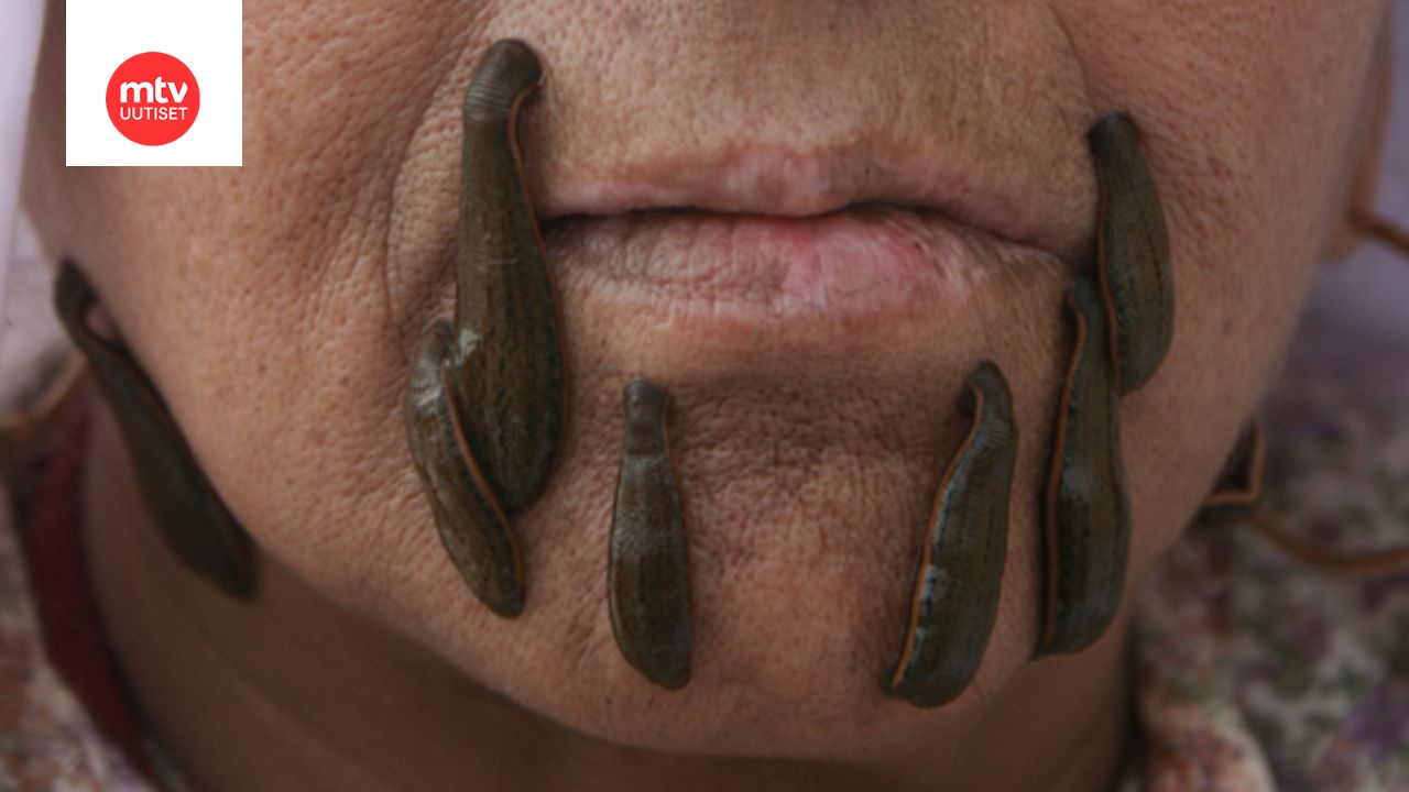 Koiran kakkaa, härän spermaa ja virtsaterapiaa − kummalliset ...